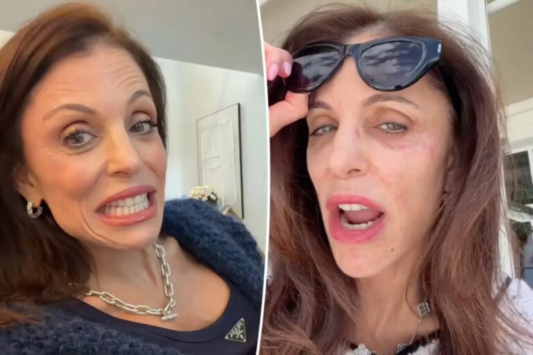 Bethenny Frankel says this common item is to blame for her facial ...