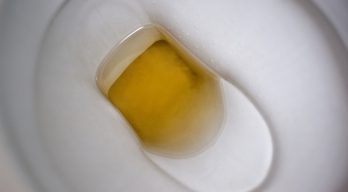 Why Is My Pee Blue? 9 Weird Pee Smells and Colors, Explained – DNYUZ