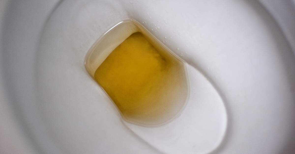 Why Is My Pee Blue? 9 Weird Pee Smells and Colors, Explained – DNYUZ