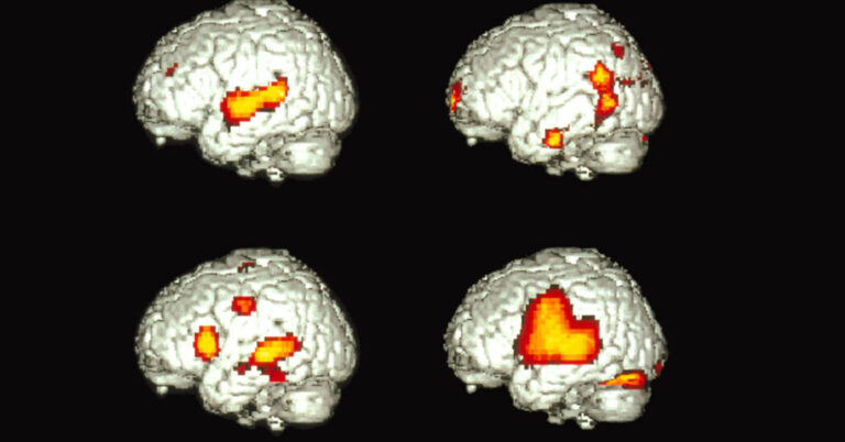 How Does One Brain Speak Two Languages? – DNYUZ